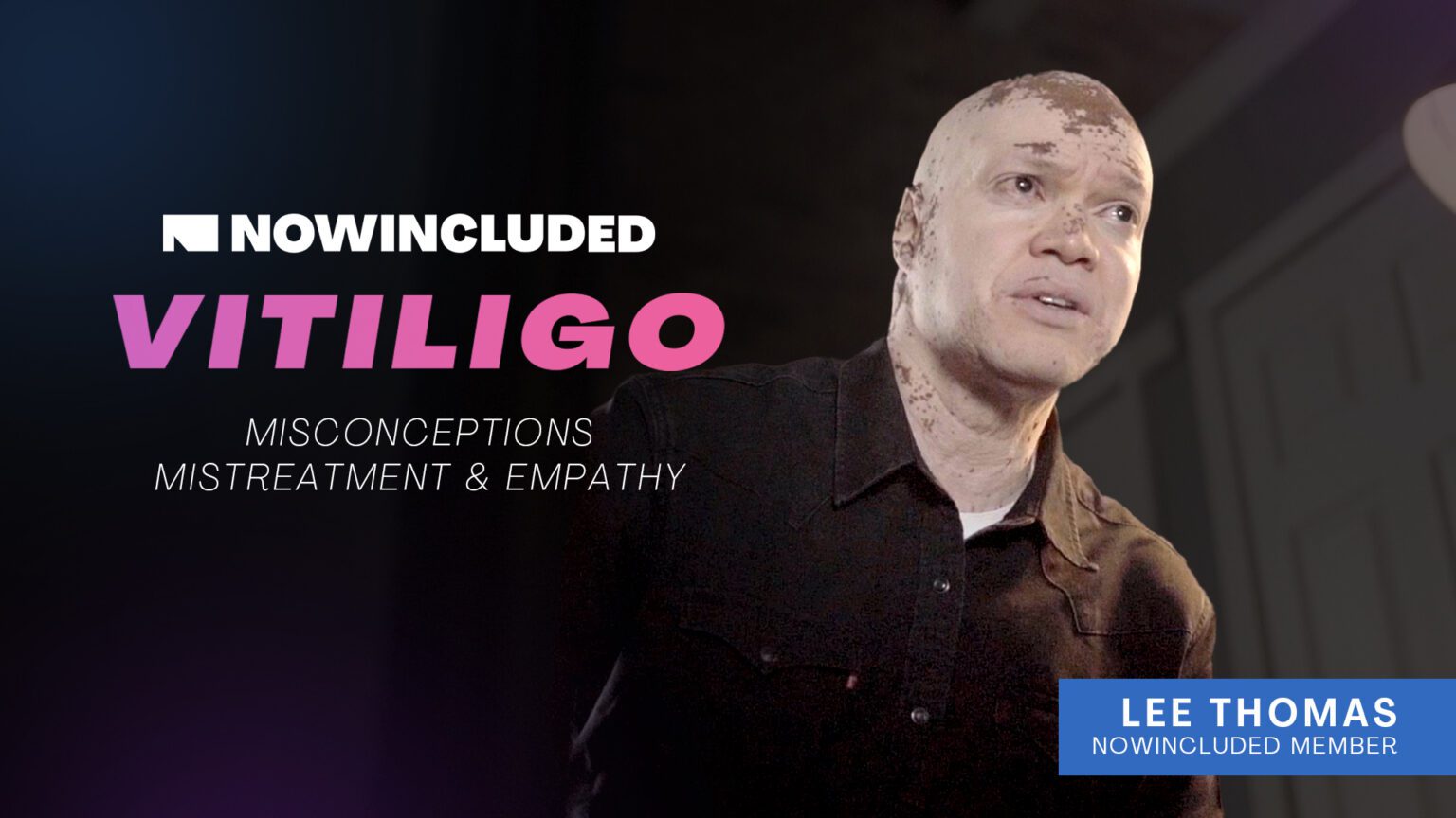 Lee's Vitiligo Journey: Overcoming Misconceptions - NOWINCLUDED